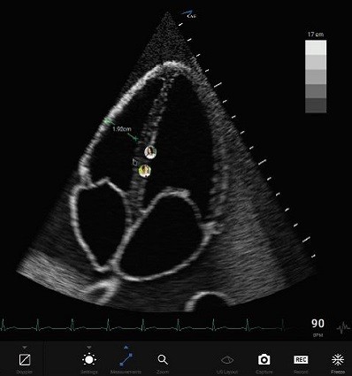 Vimedix - Medical Simulator